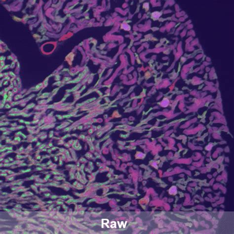 Deconvolution What Is It Deconvolution Is A Mathematical Method To