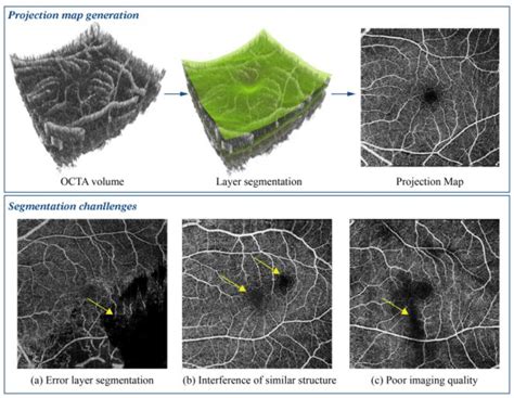 The Generation Of Projection Map And The Challenges In The Rv Download Scientific Diagram