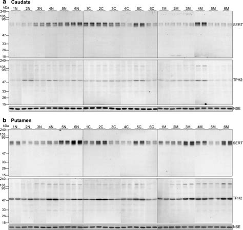 Representative Immunoblots Of Serotonin Transporter Sert Tryptophan Download Scientific