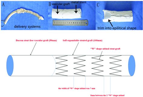 Self Design Stent Graft A Compacted Modified Stent Graft With The
