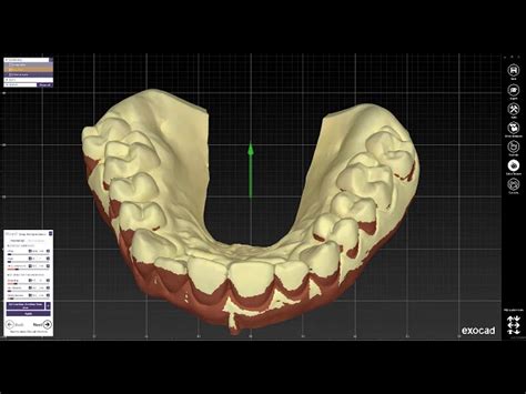 Exocad Quick Guide Using The Cutback Library Quotthimble Eeschema
