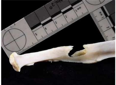 —entrance Defect On The Ventral Surface Of Left Rib 7