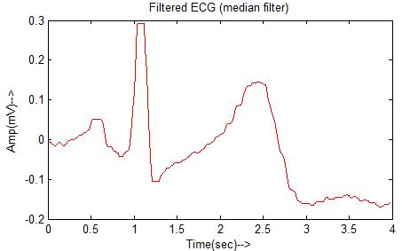 Filtered ECG Signal Using Median Filter Download Scientific Diagram