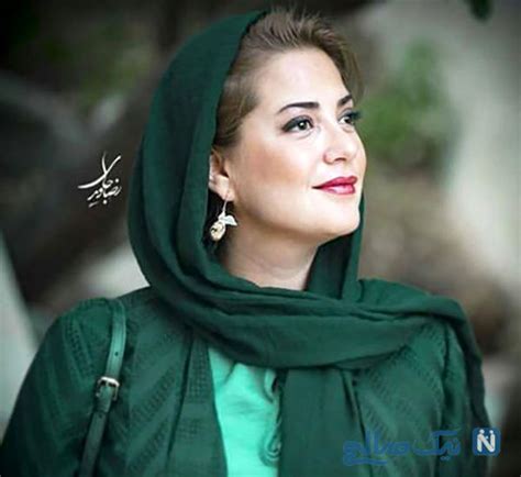 رونمایی طناز طباطبایی از چهره بعد از عمل زیبایی اش طناز طباطبایی بعد