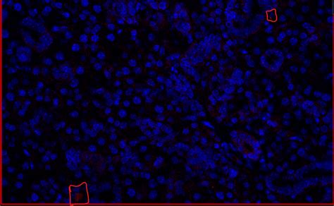 Removing False Positives From Cell Detection In Qupath Image