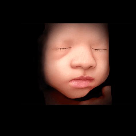 Turn 3d 4d Ultrasounds Into Lifelike Images