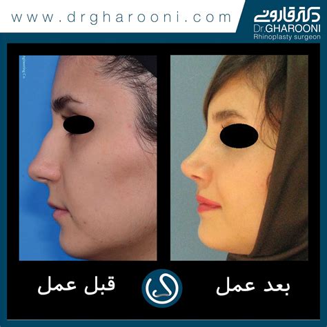 معیار زیبایی در ایران چیست و آیا زیبایی معیاری دارد؟