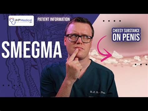 Doctor Explains SMEGMA White Yellow Cheesy Substance On Your Penis Treatment And