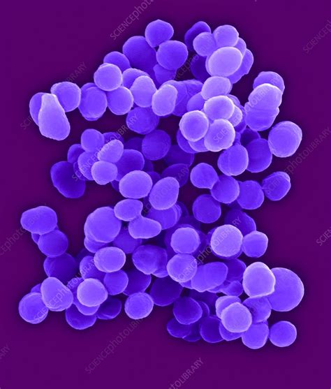Aerococcus Urinaeequi Coccoid Prokaryote Sem Stock Image C032