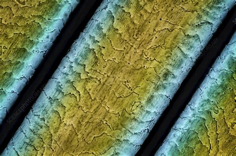 Strands Of Human Hair Light Micrograph Stock Image C056 8450 Science Photo Library