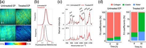 Looking For A Perfect Match Multimodal Combinations Of Raman Spectroscopy For Biomedical
