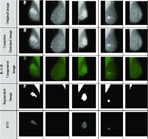 Sample Of Segmented Images Download Scientific Diagram