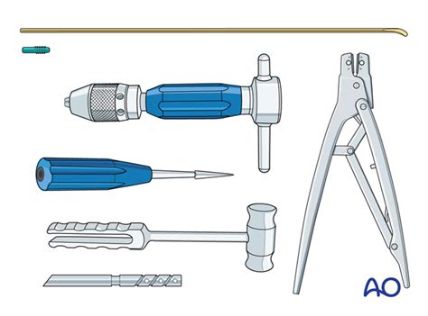 Elastic Nailing For Simple Transverse Tibial Fracture