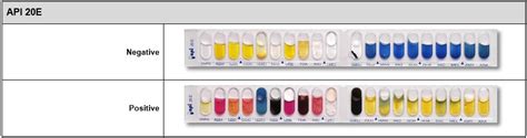 Api For Microorganism Identification Api Test For Bacteria Api 20e