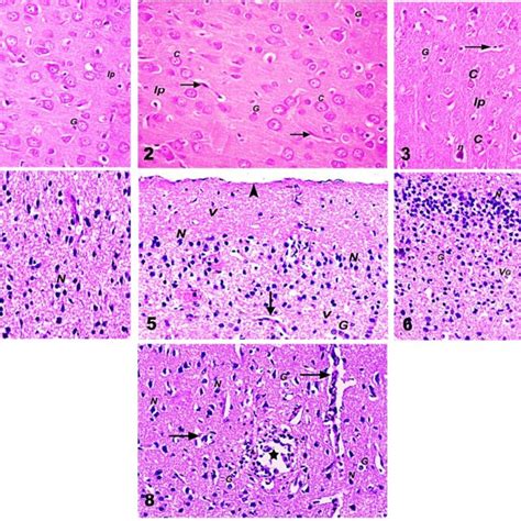 Photomicrographs Of Cerebral Cortex Sections Of Adult Male Mice In Photomicrographs Of Cerebral Cortex Sections Of Adult Male Mice In
