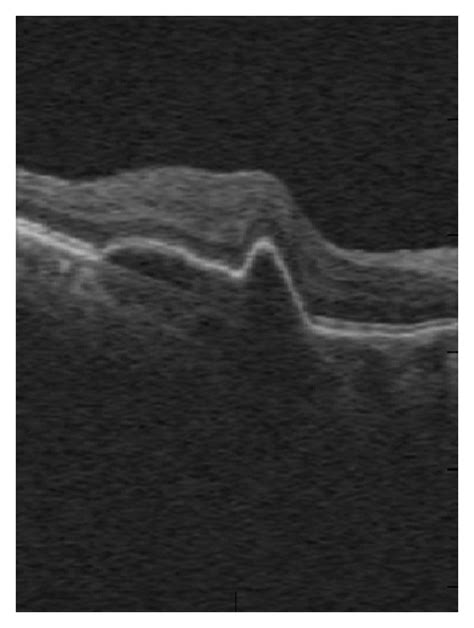The Results Of Applying Non Homomorphic Methods On Proposed Image In Download Scientific