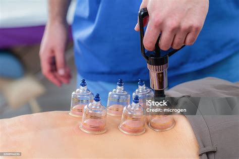 물리 치료 세션 중 등에 부항 치료를 받고 있는 여성 흡입 컵은 근육 긴장을 완화하고 혈액 순환을 개선하며 통증 완화 및 이완을 촉진하는 데 도움이 됩니다 2명에 대한 스톡