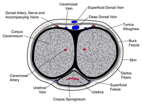 Mr Imaging Of Nonmalignant Penile Lesions Radiographics