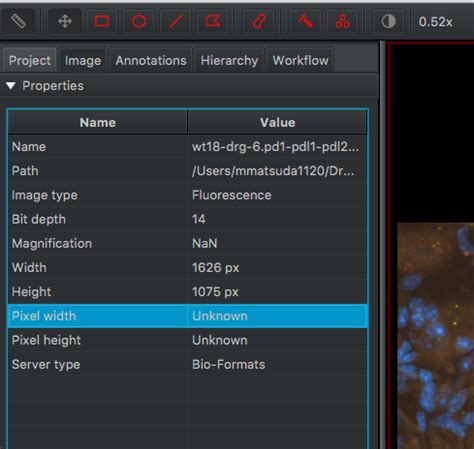 Automatic Quantification Issue Issue 163 Qupath Qupath GitHub