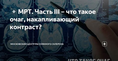 🔹МРТ Часть Iii что такое очаг накапливающий контраст Московский центр рассеянного