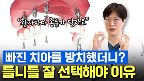 치아가 없으면 어떻게 될까” 환자에 따른 틀니의 종류와 치료방법 군포 산본 미래플란트치과의원 Youtube