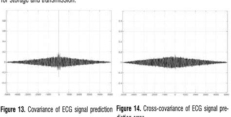 Figure 14 From Predictive Ecg Coding Using Linear Time Invariant Models