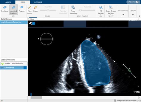Label D Ultrasound Series Using Medical Image Labeler MATLAB Simulink