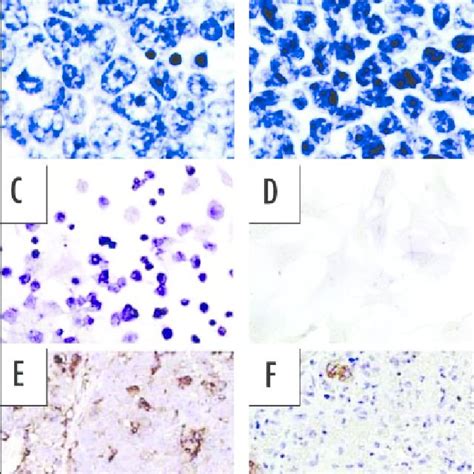 Myc Oncogene Inactivation Induces The Differentiation Of A Variety Of Download Scientific