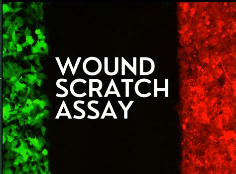 Wound Scratch Assay Using Live Cell Imaging System Nanoentek Blog