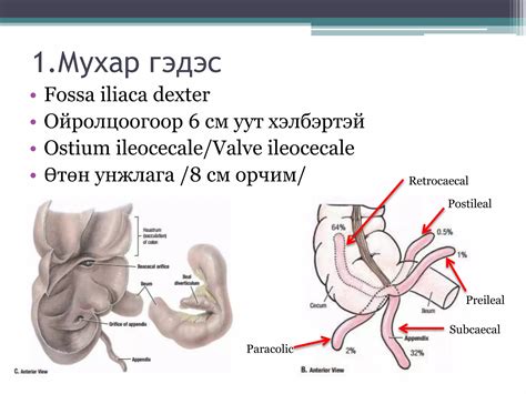 Бүдүүн гэдэсний хорт хавдар Pptx