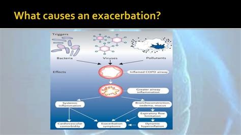 COPD Management Of Acute Exacerbation PPTX