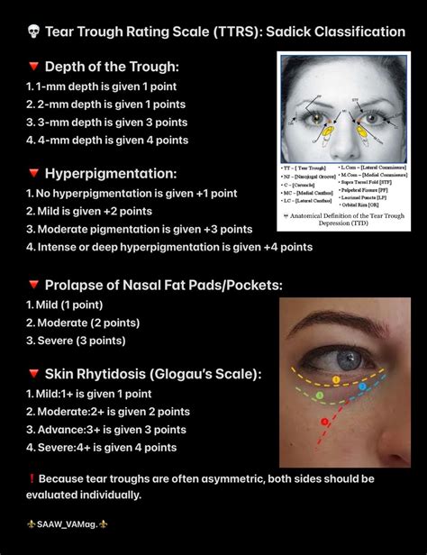 Tear Trough Rate Score Ttrs Sadick Classification Yousef Nazari Md Posted On The Topic