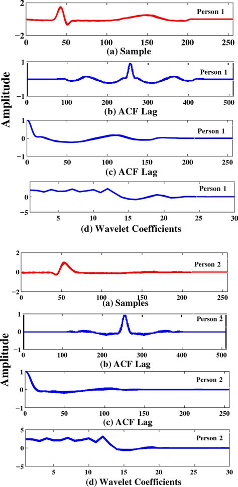 Figure 3 1 From Method Of Human Identification Using Ecg Signals Based