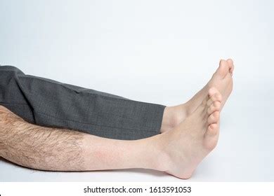 Legs Hair Removal Men Before After Stock Photo Shutterstock