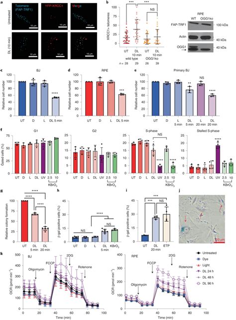Nature子刊：端粒氧化损伤可以触发细胞衰老僵尸opreskobiology