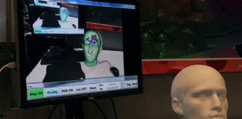 Print3d World Kinect Fusion Scanner 3d Y Realidad Aumentada Para Neurocirujanos