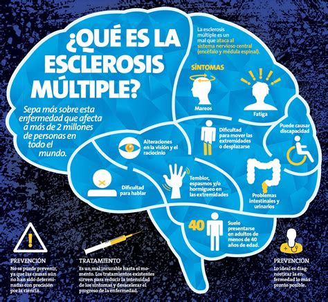 Neuralgia Del Trigémino En La Esclerosis Múltiple Gamma Knife