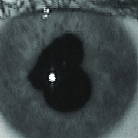 Iris Boundary Localization Download Scientific Diagram
