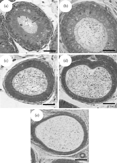 2 See Colour Insert T S Of Different Segments Of Rat Epididymis Download Scientific