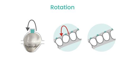 orthodontic tooth movement ultimate guide for doctors 2023