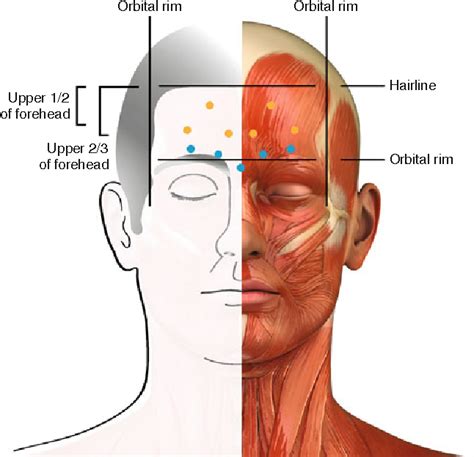 Anatomy Of Forehead Scalping Forehead Flap Plastic Surgery Key
