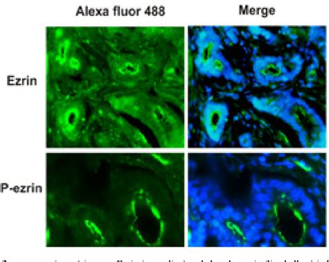 Figure 1 From Quantification Of Protein Expression On An Immunofluorescence Section By Using The