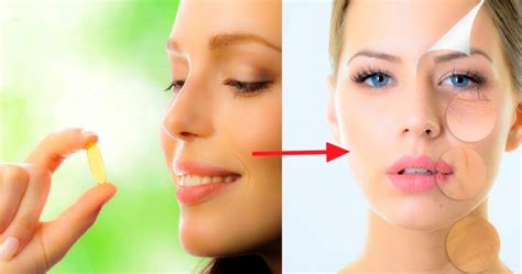 როგორ გამოვიყენოთ E ვიტამინი ნაადრევი სიბერის წინააღმდეგ უთხარით არა ლაქებსა და ნაოჭებს