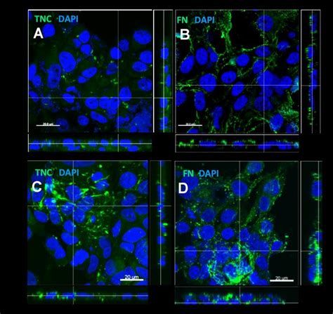 7 Cellular Distribution Of Tenascin C And Fibronectin In U 87 Mg Download Scientific Diagram