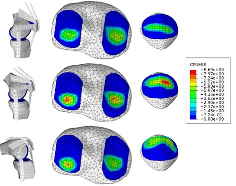 Figure 3 1 From Statistical Modeling To Investigate Anatomy And Function Of The Knee Semantic