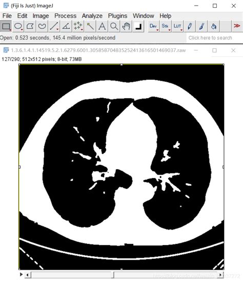 Imagej下载安装使用image J下载 Csdn博客