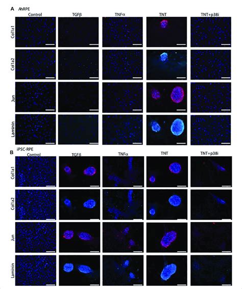 Ipsc Rpe Contractile Aggregates Are Reduced By P38 Inhibition Ahrpe Download Scientific