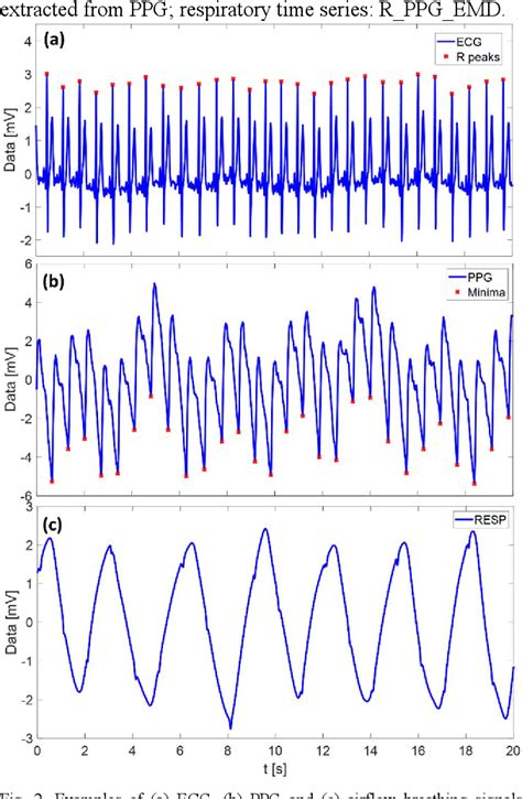 Figure 2 From A Portable Multisensor System To Assess Cardiorespiratory