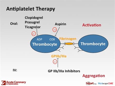 Triple Antiplatelet Therapy Rationale And Role In Acs Transcript
