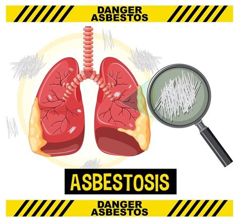 Health Effects Of Asbestos Exposure